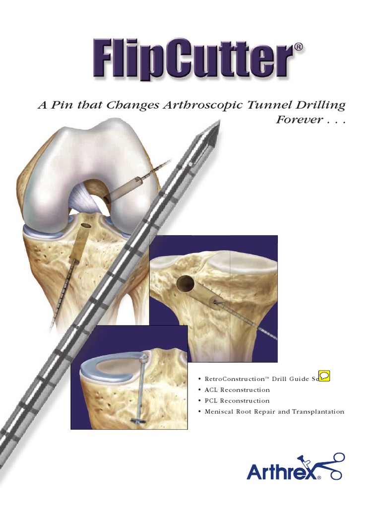 FlipCutter a Pin That Changes Arthroscopic Tunnel Drilling Forever...[1 ...