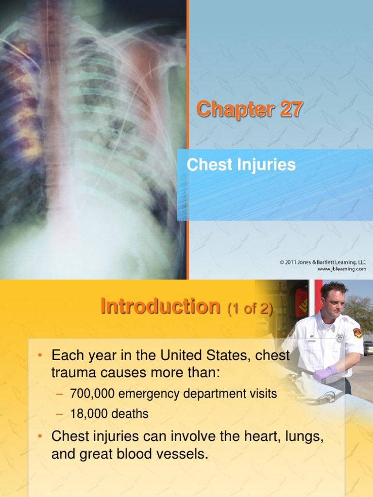 Chapter 27 Chest Injuries | PDF | Thorax | Lung
