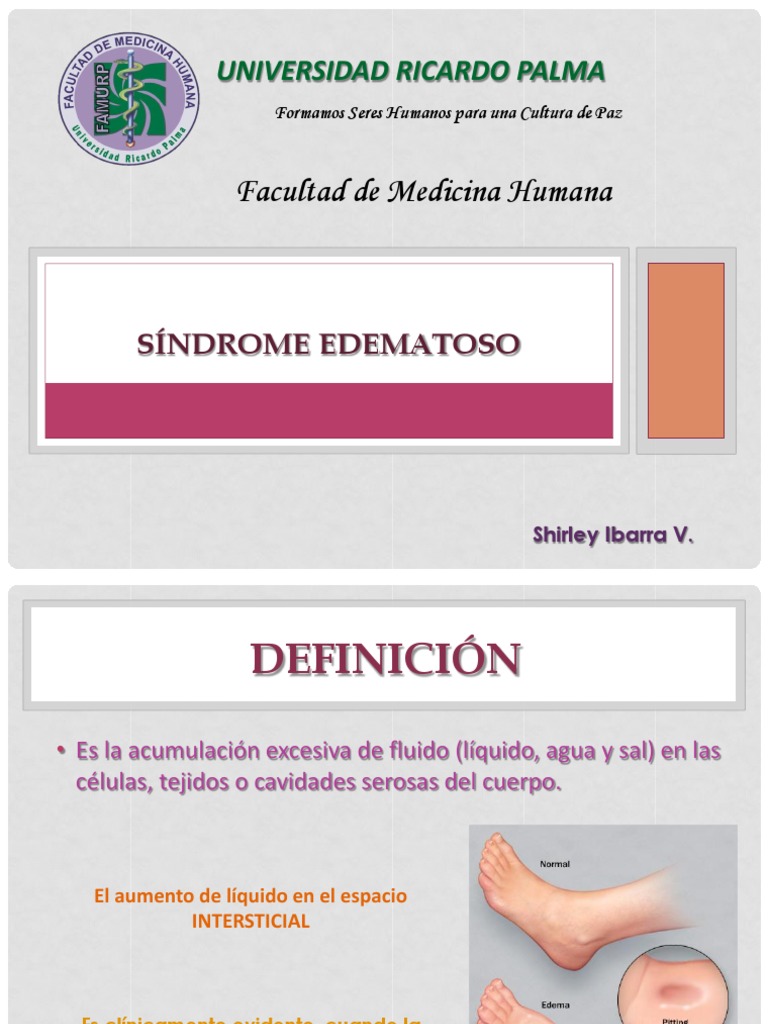 Síndrome Edematoso | PDF | Edema | Enfermedades y trastornos