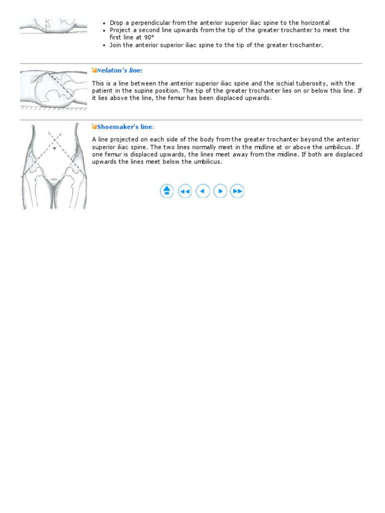Nelaton's Line | PDF