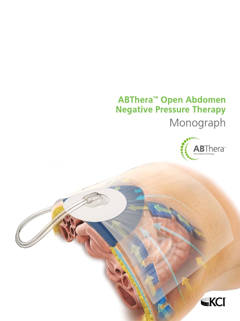 ABThera Monograph | Sepsis | Surgery