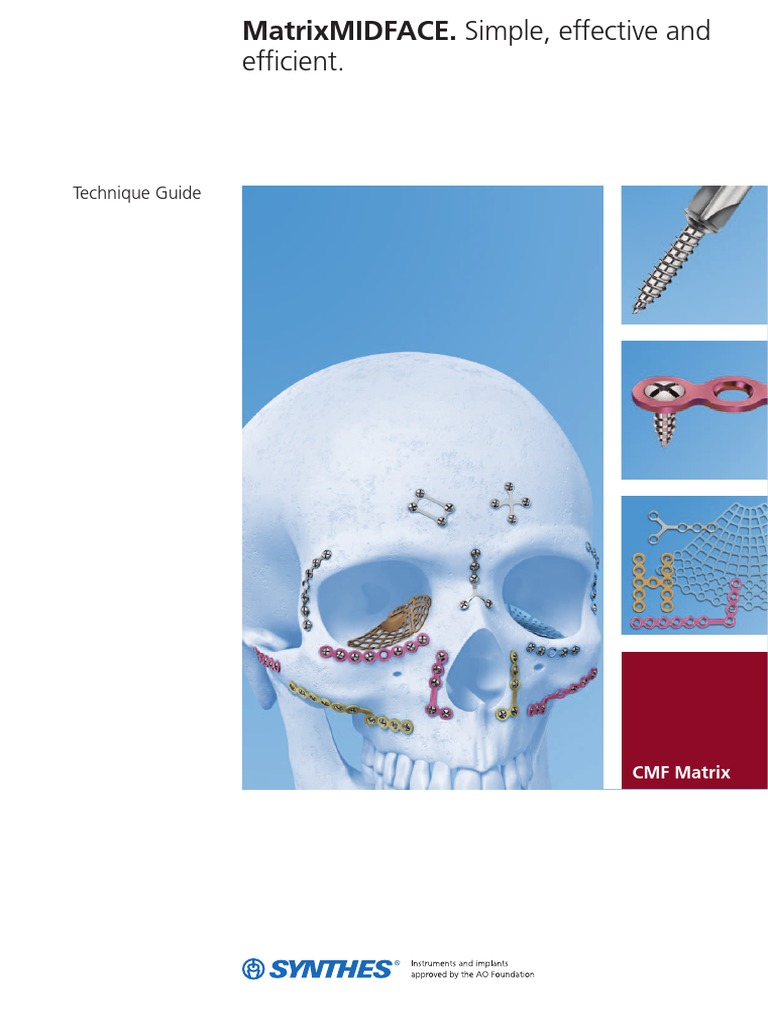 Synthes Titanium Implant Plates | PDF | Drill | Fixation (Histology)