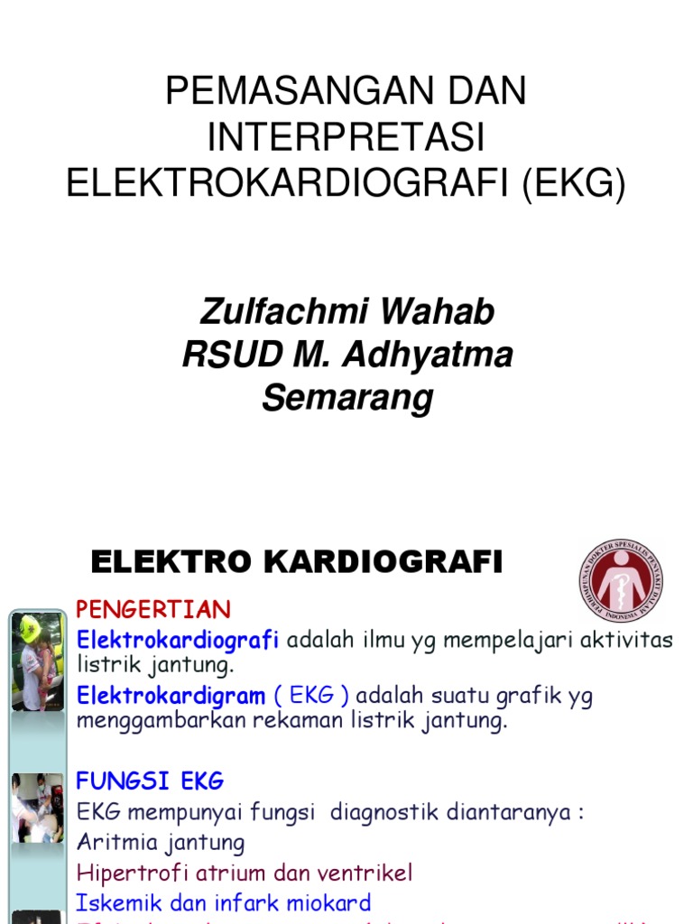 Panduan Interpretasi EKG 12 Lead | PDF | Teknologi & Rekayasa