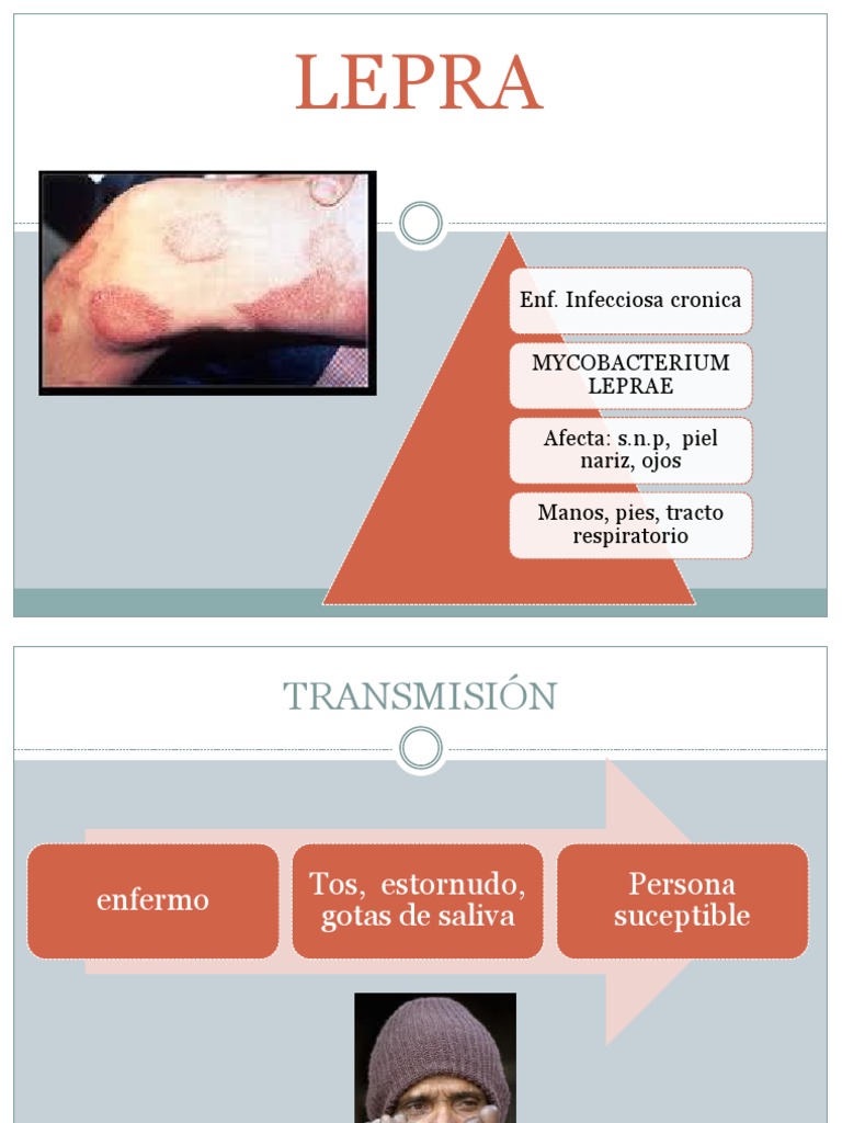 Lepra | PDF