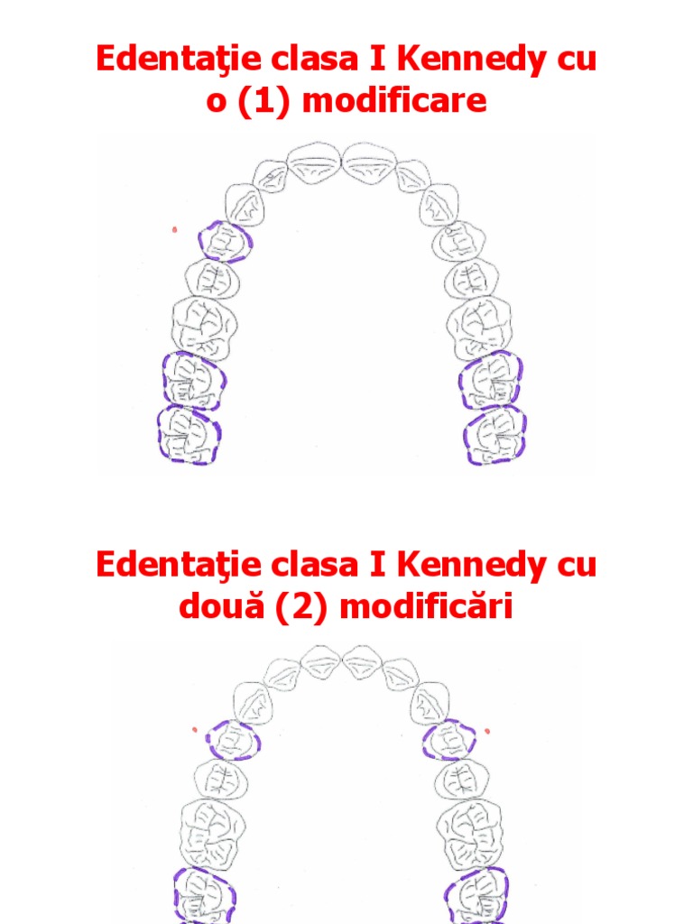 Clasele de Edentatie | PDF