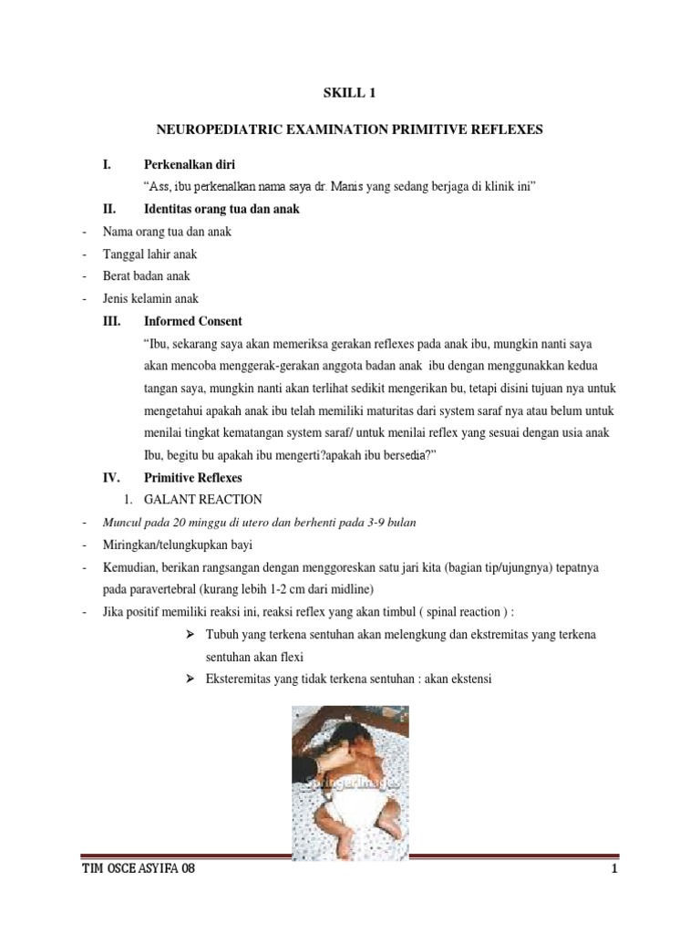 Primitive Refleks | PDF