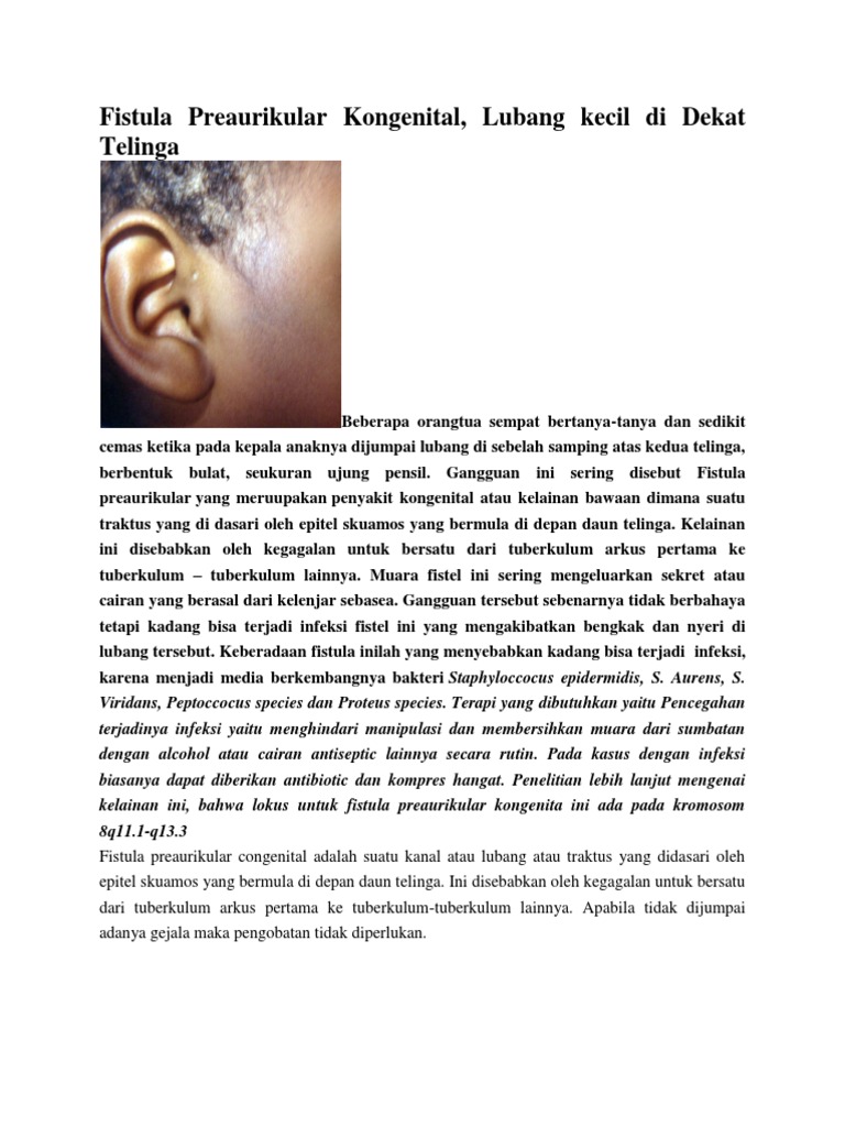 Fistula Preaurikular Kongenital | PDF