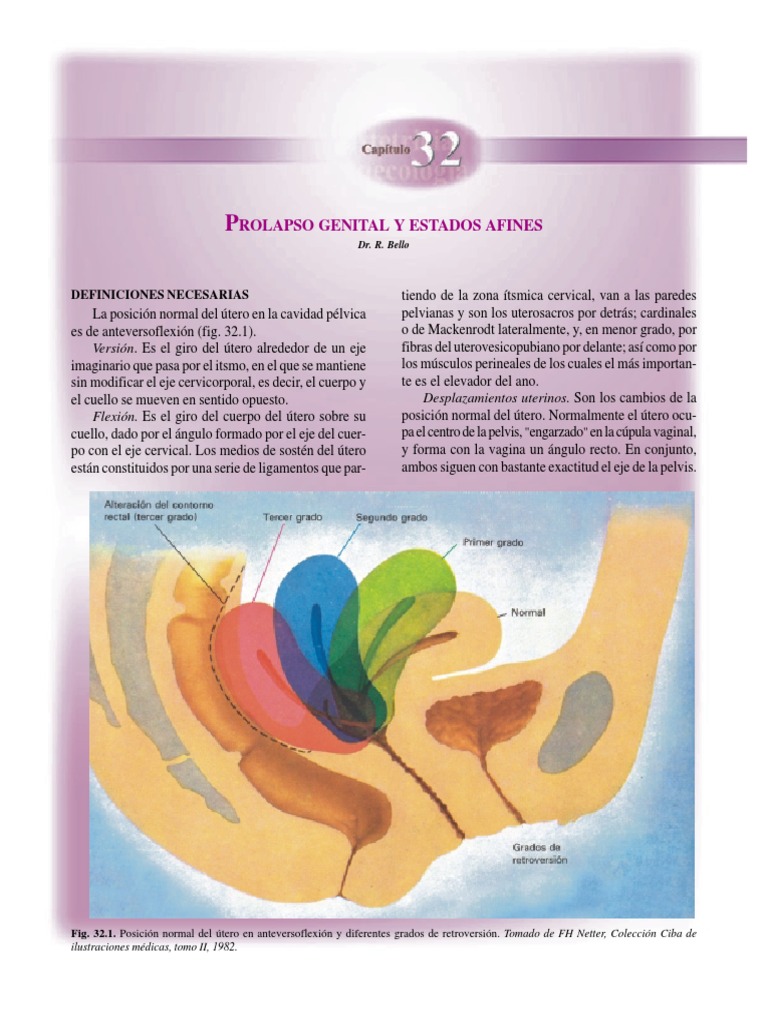 Cap32 - Prolapso Genital y Estados Afines | PDF | Útero | Vagina