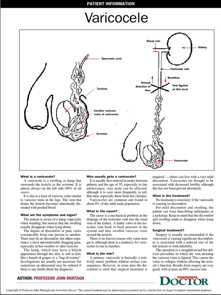Varicocele Pdf Medicine Diseases And Disorders