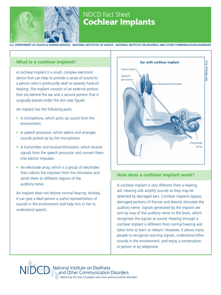 Understanding Cochlear Implants: Overview | PDF | Hearing Loss ...