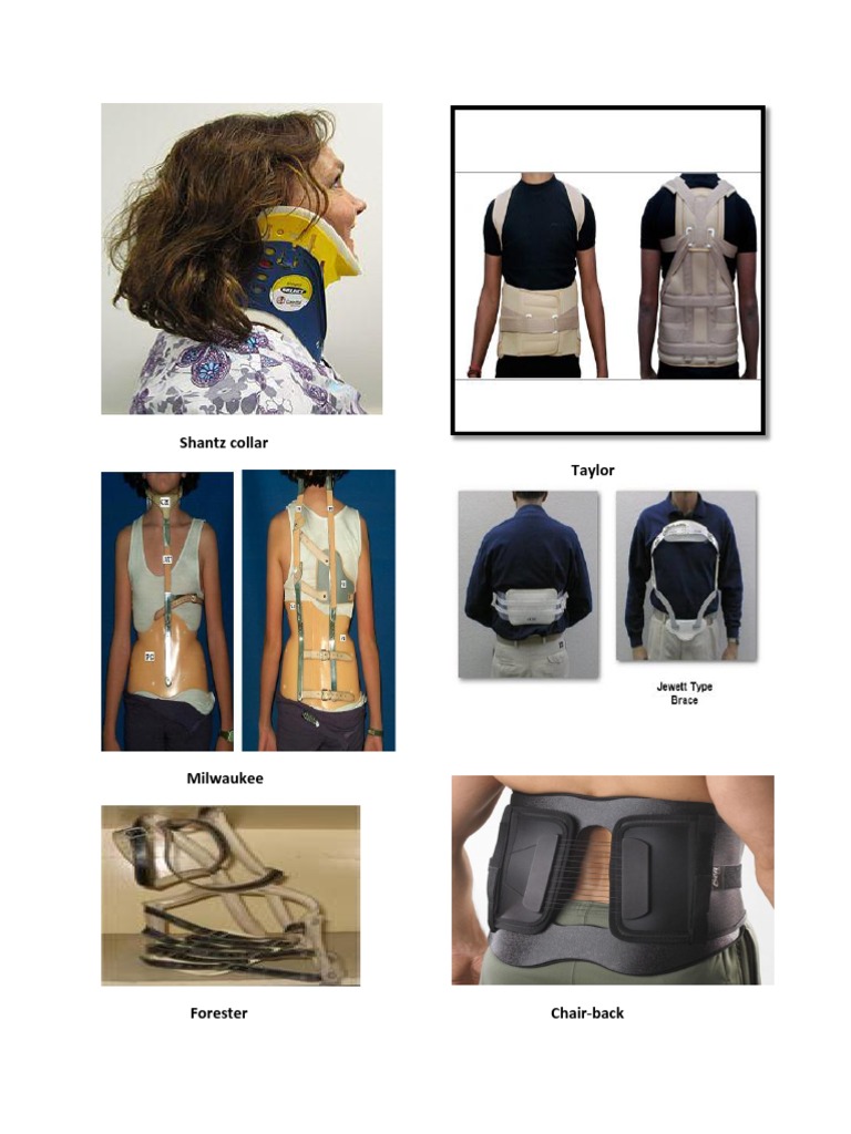 Shantz Collar Taylor | PDF
