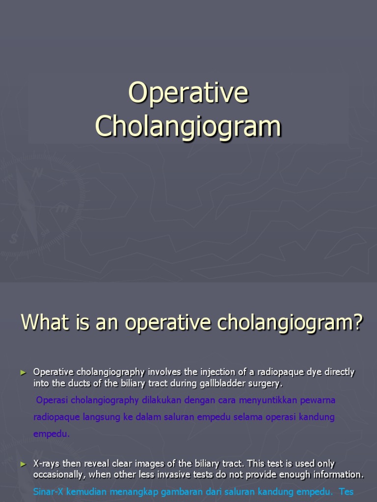 Operative Cholangiogram | PDF | Organs | Gastroenterology