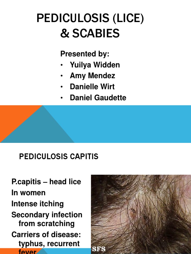 Pediculosis Capitis Treatment