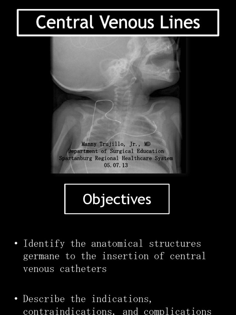 Central Venous Line Insertion Guide | PDF | Vein | Angiology