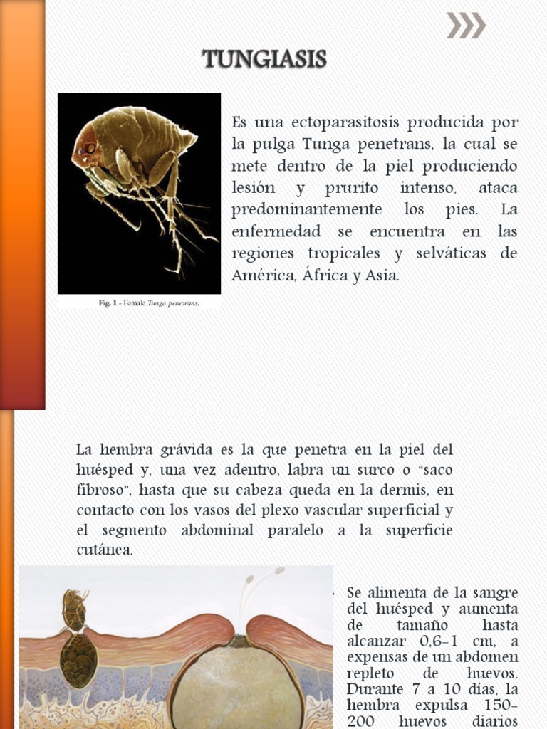 Tungiasis: diagnóstico y tratamiento | PDF | Medicina | Medicina CLINICA