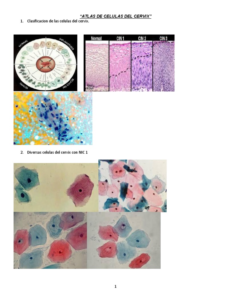 Atlas de Celulas Del Cervix | PDF