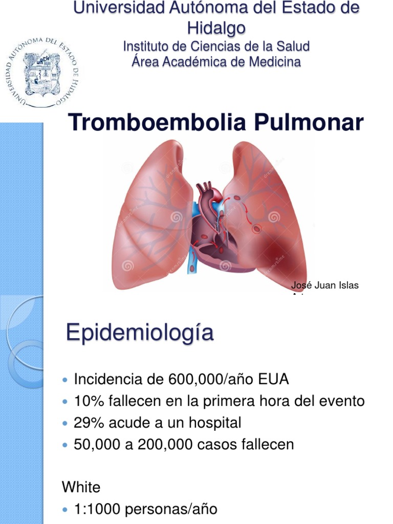 Tromboemebolia pulmonar | Trombo | Sangre
