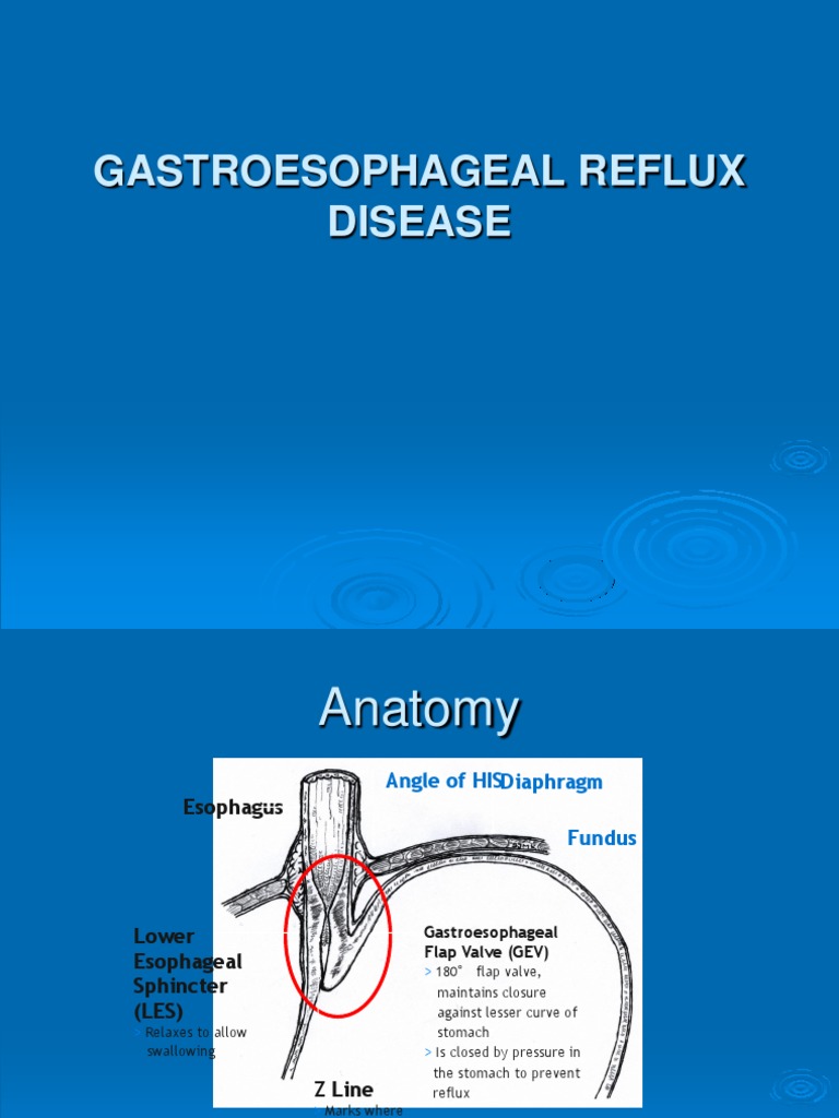 Gerd | Esophagus | Gastroesophageal Reflux Disease