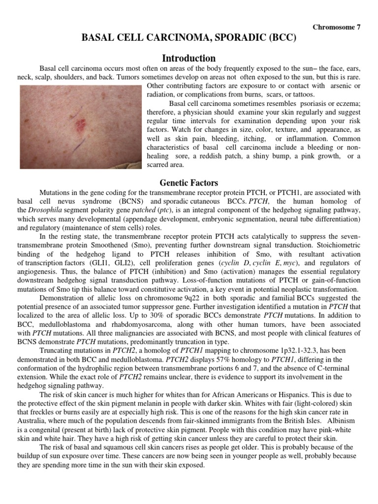Basal Cell Carcinoma, Sporadic (BCC) : Genetic Factors | PDF | Biopsy ...