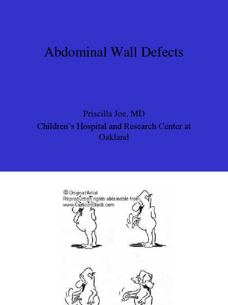 Abdominal Wall Defects | PDF | Congenital Disorder | Abdomen