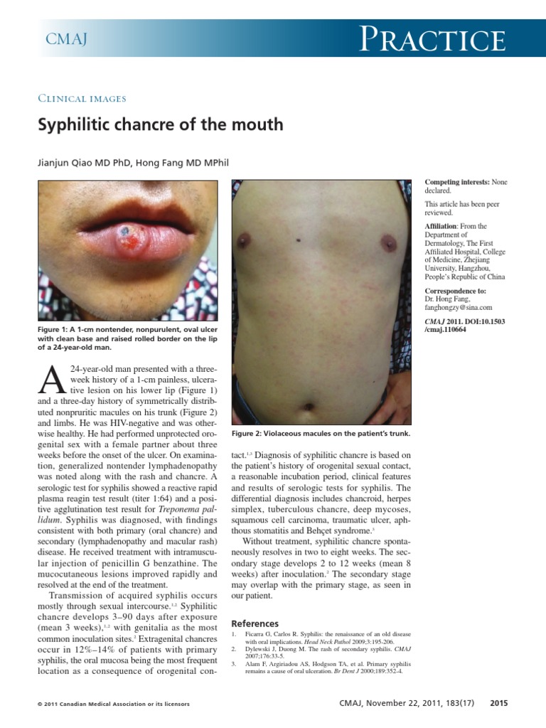 Practice: Syphilitic Chancre of The Mouth | PDF | Diseases And ...