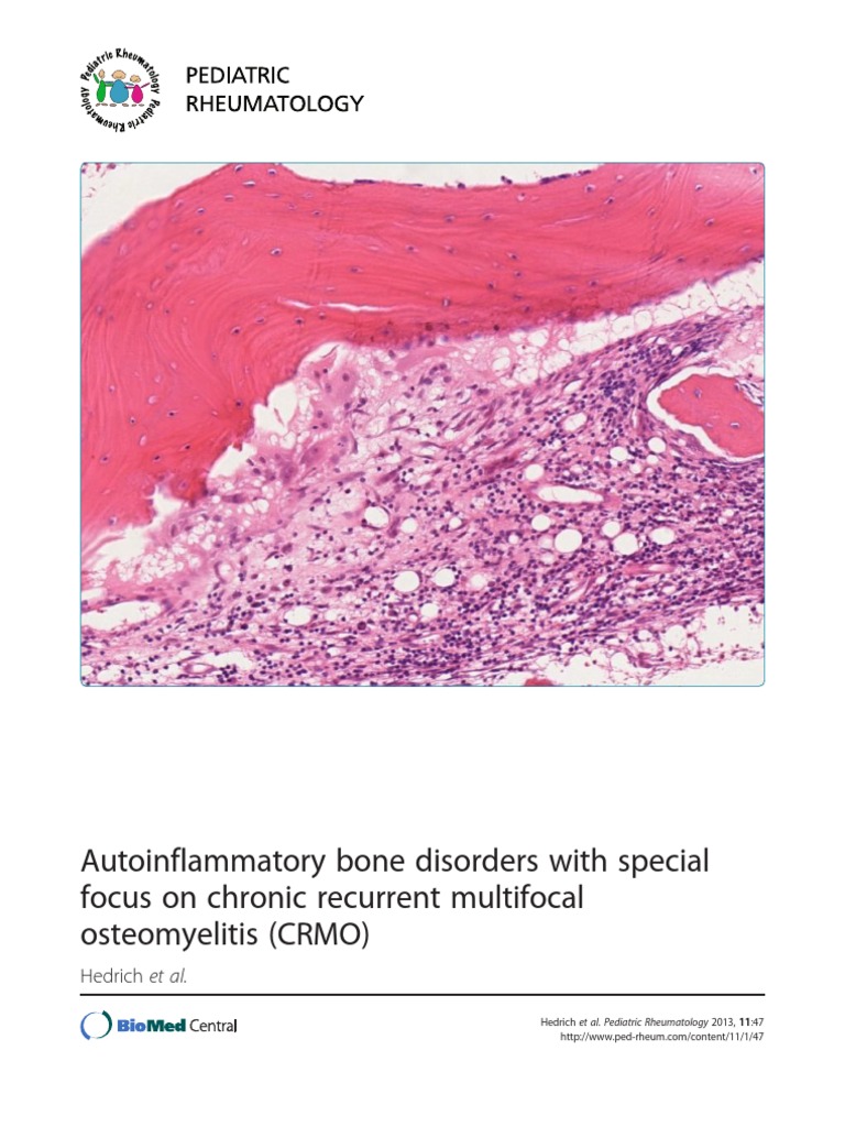 Autoinflammatory Bone Disorders With Special Focus On Chronic Recurrent ...