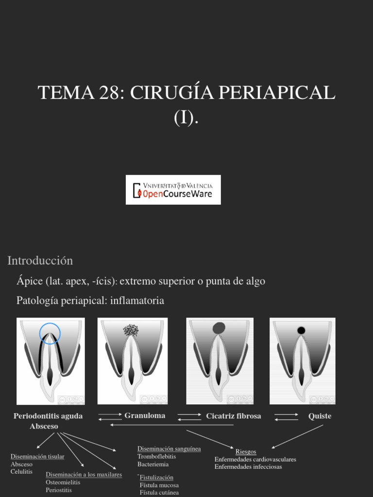 cirugia apical (1) | Diente humano | Cirugía