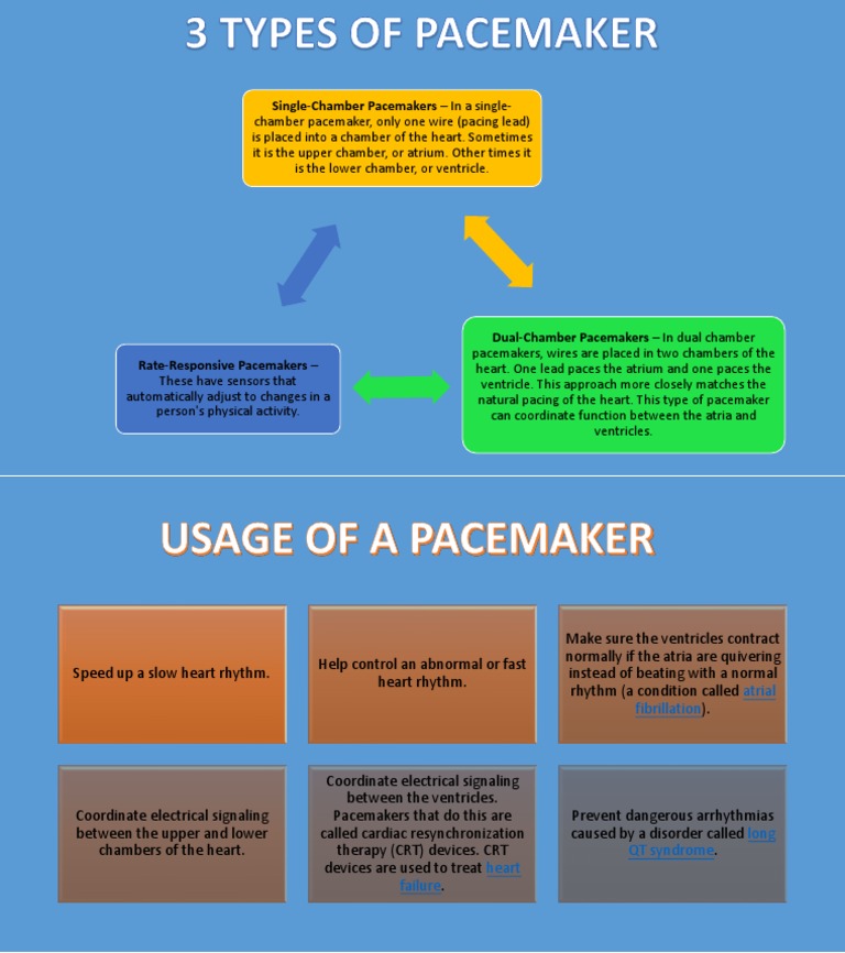 Types of Pacemakers - Single Dual and Rate Responsive | PDF