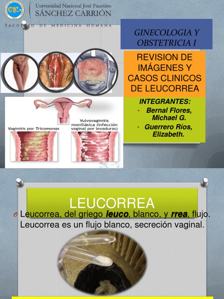 Casos Clínicos de Leucorrea y Candidiasis | PDF | Vagina | Mamíferos ...