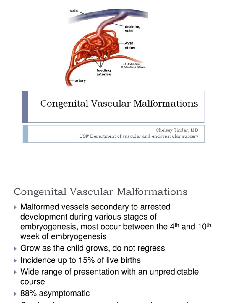 Congenital Vascular Malformations | Vein | Blood Vessel