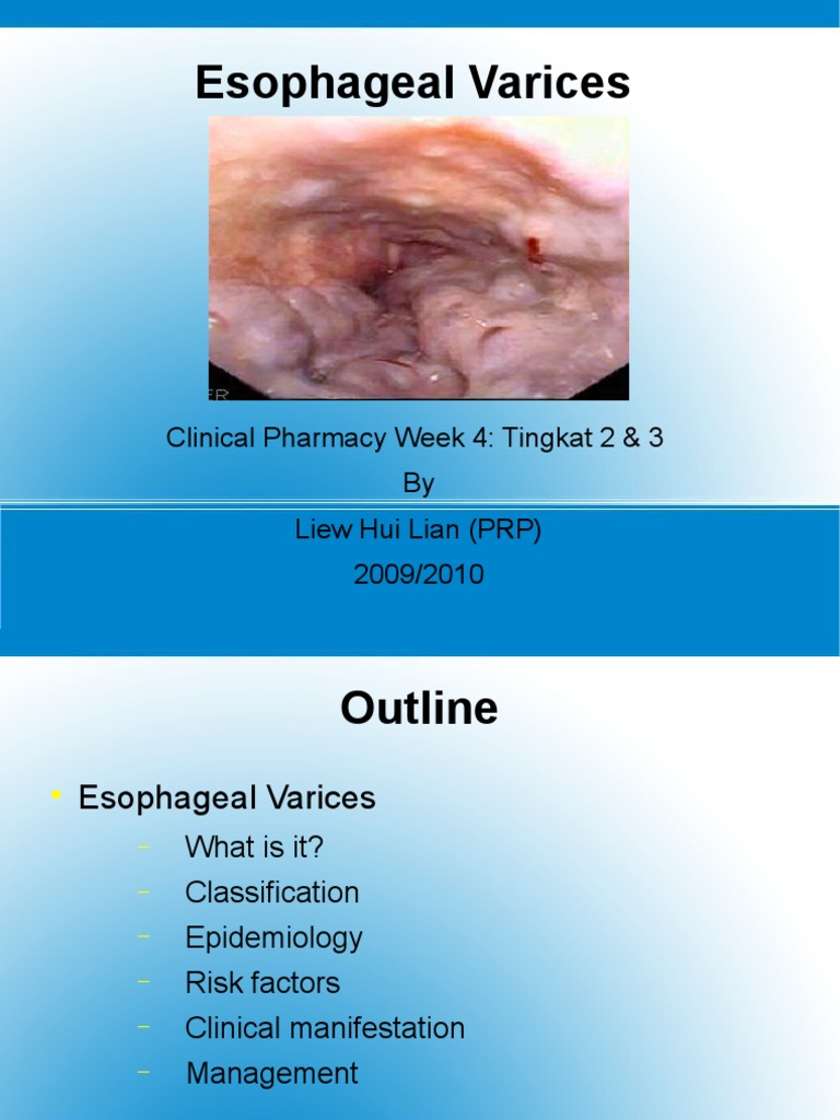 Esophageal Varices Week 4 T2T3 | PDF | Digestive Diseases ...