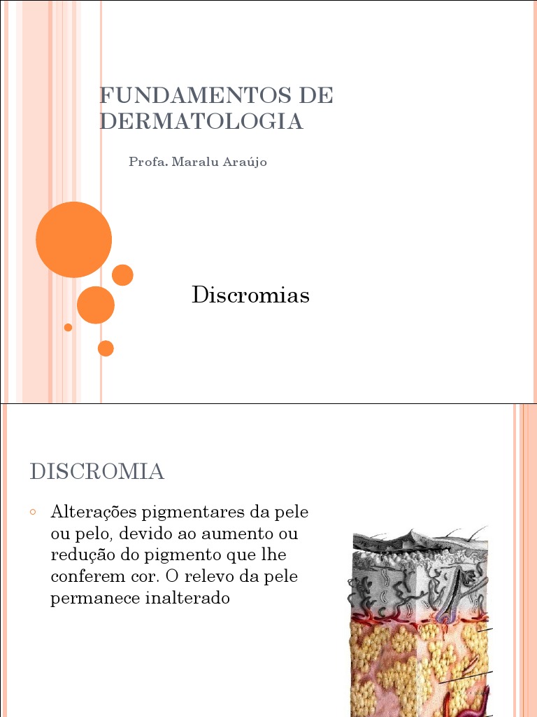 Tipos de Discromias na Pele | PDF