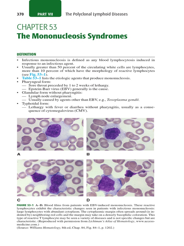 The Mononucleosis Syndromes | PDF | Infection | Immunology