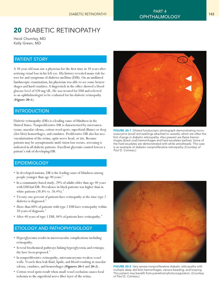 Diabetic Retinopathy | PDF | Ophthalmology | Diseases And Disorders