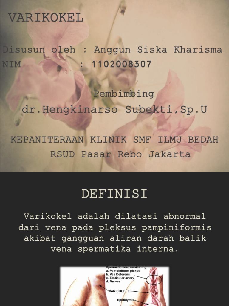 Varikokel | PDF