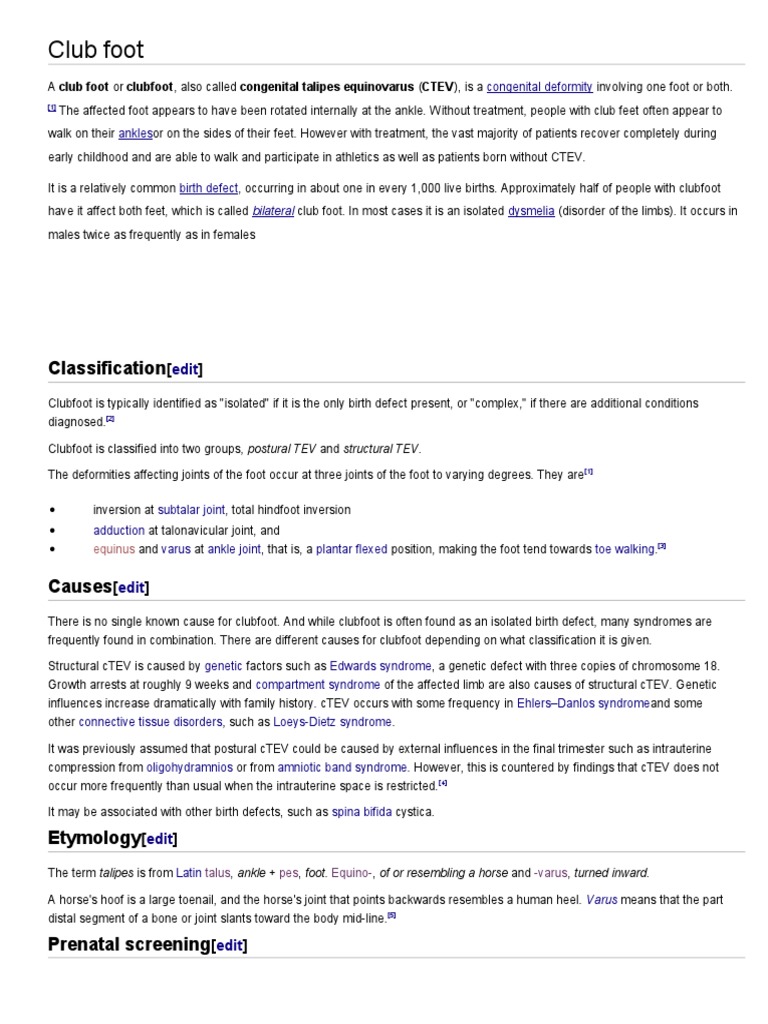 Club Foot: Classification | PDF | Medical Specialties | Health Sciences