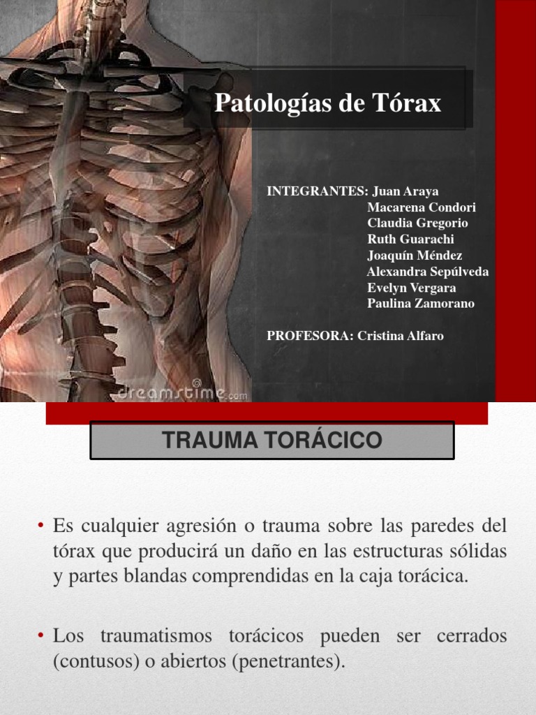 Patologías y Trauma del Tórax | PDF | Lesión | Tórax (anatomía humana)