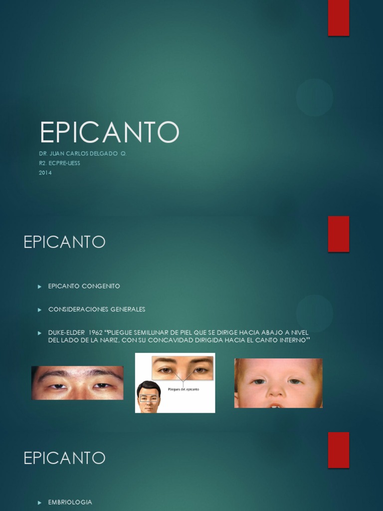 Epicanto Presentacion1 | PDF