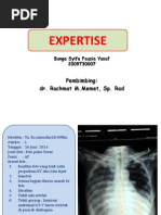 Diagnosis Banding Opasitas Pada Rontgen Thorax | PDF | Kajian Bahasa ...