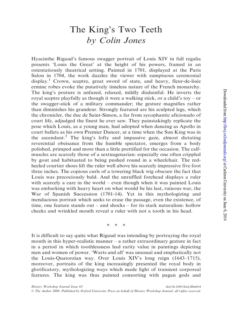 Louis XIV: The Significance of His Teeth | PDF | Louis Xiv Of France ...