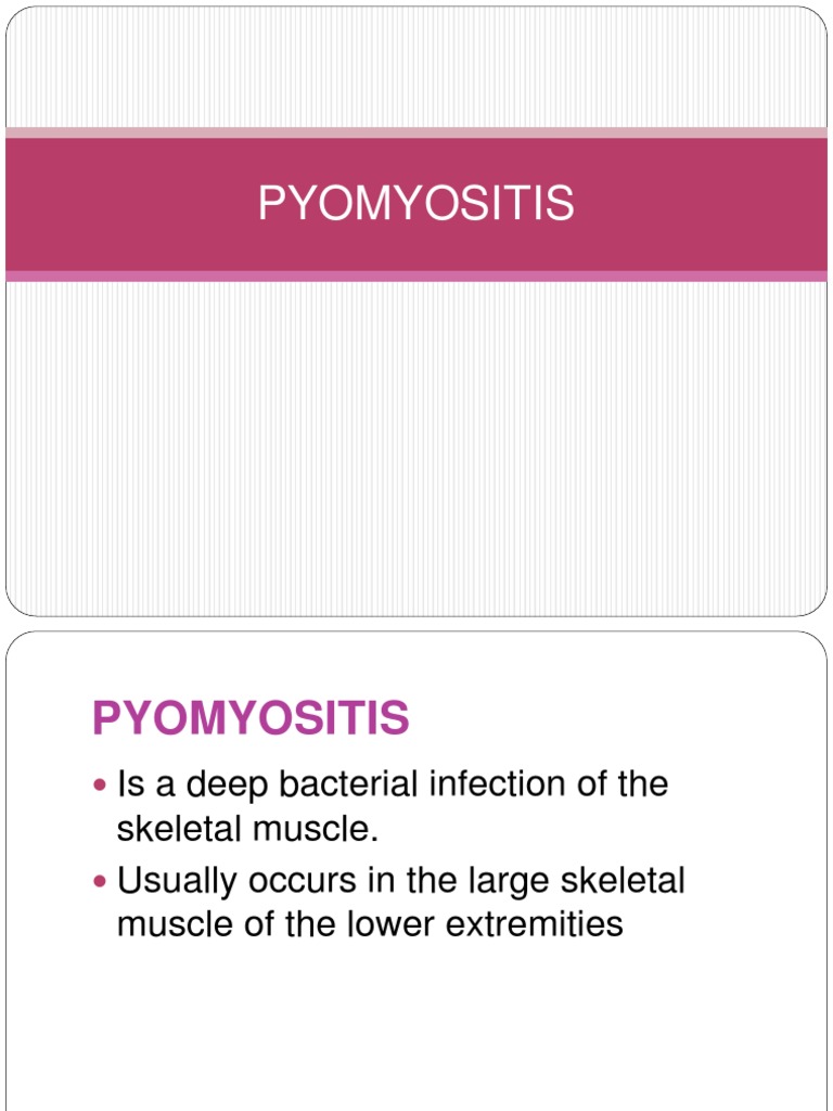 PYOMYOSITIS | Relaxation (Psychology) | Pain
