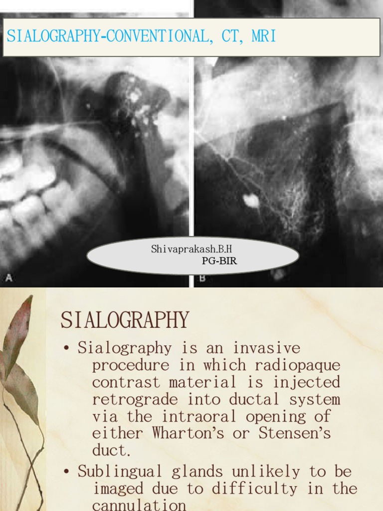 Sialography Conventional, CT, Mri | PDF | Medical Specialties | Human ...