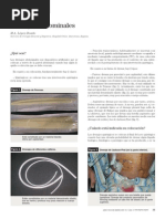 Cuidados y manejo del drenaje Hemovac | PDF | Herida | Drenaje