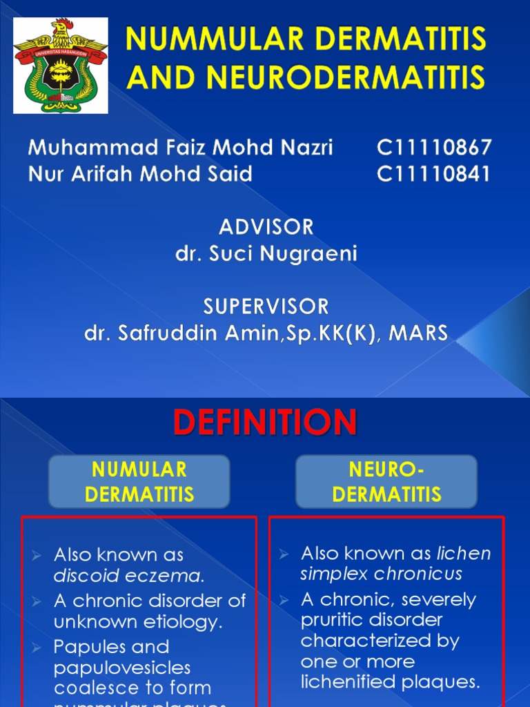 Dermatitis Numularis and Neurodermatitis | Dermatitis | Cutaneous ...
