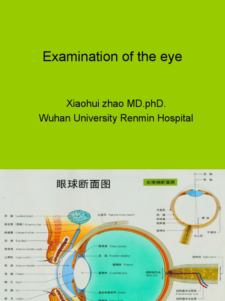 Examination of The Eye: Xiaohui Zhao MD - Phd. Wuhan University Renmin ...