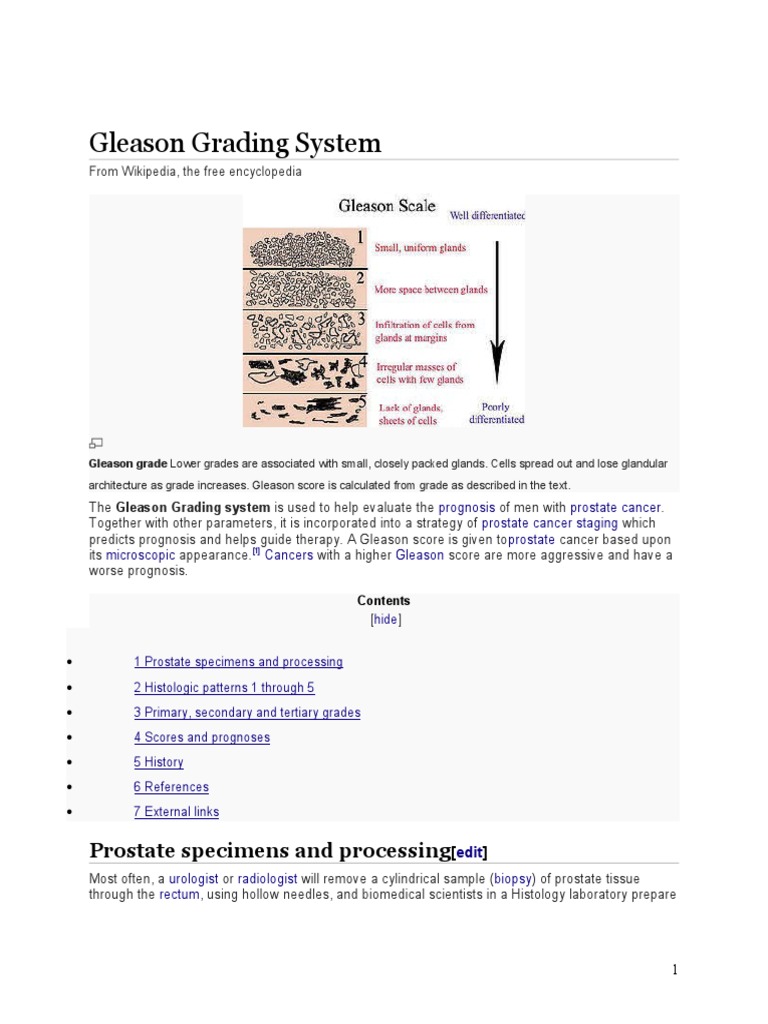 Gleason Grading System | PDF | Prostate | Biology