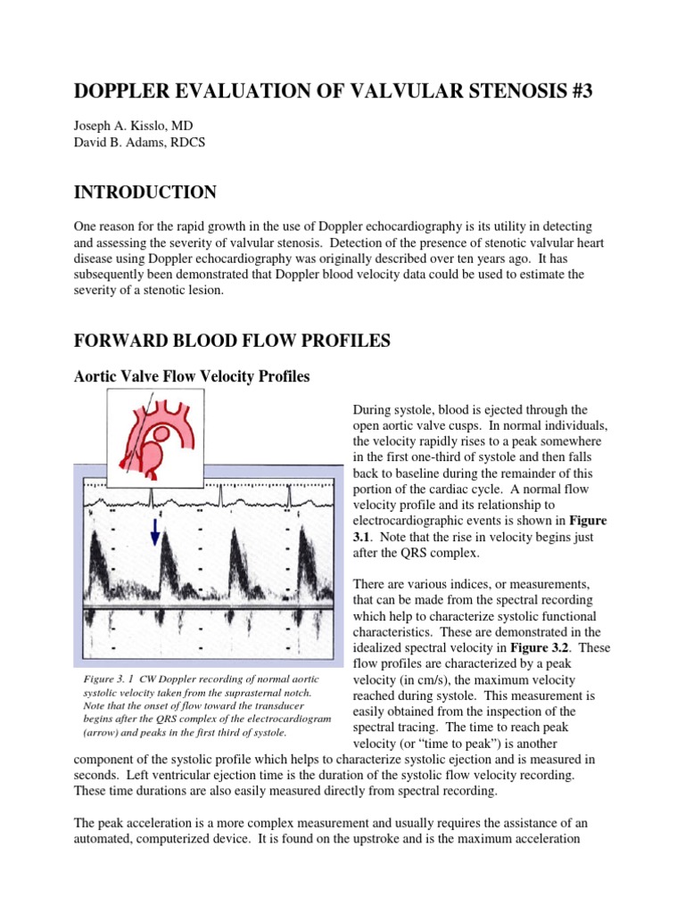 Doppler Evaluation of Valvular Stenosis #3: Aortic Valve Flow Velocity ...
