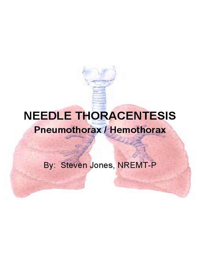 Pneumothorax-Hemopneumothorax Needle Decompression | Download Free PDF ...