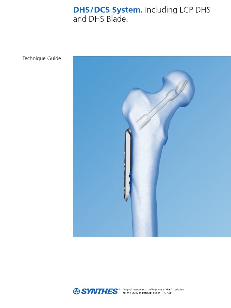 Dynamic Condylar Screw Dcs | Hip | Screw