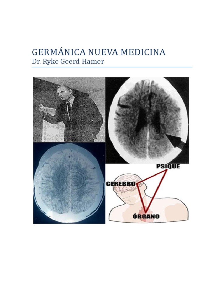 Hammer. Nueva Medicina | PDF | Psique (psicología) | Cerebro